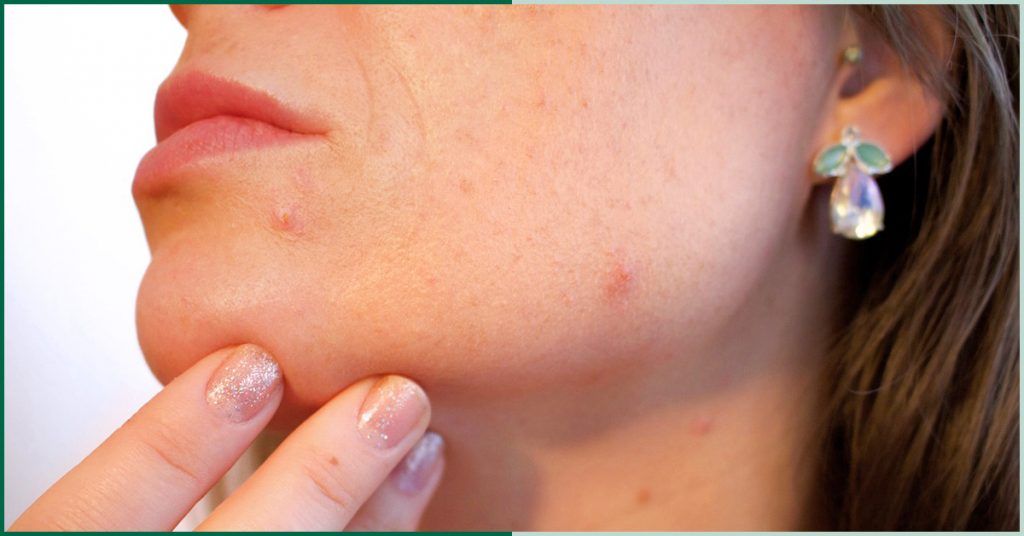 Beware These Lesser-Known Causes of Skin Issues - Christine Valmy ...